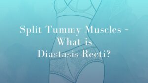 Diastasis Recti: Causes, Signs & Recovery Tips | Dr Mark Kohout